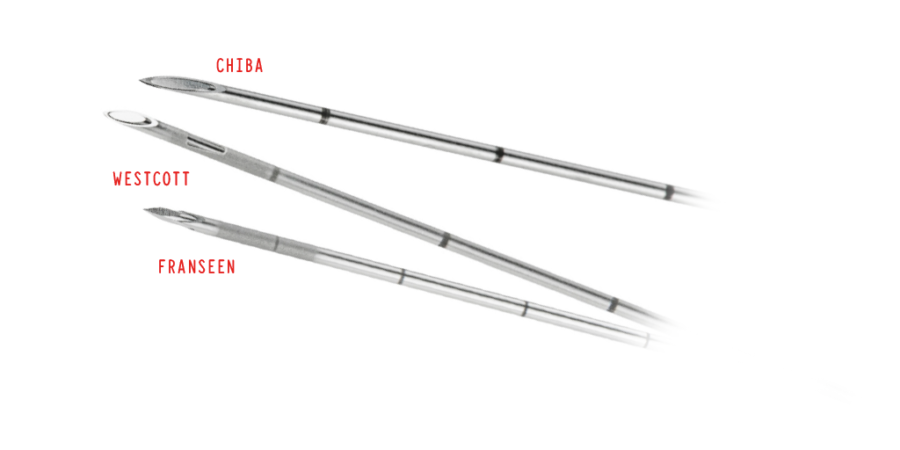FINE NEEDLE ASPIRATION FOR CYTOLOGICAL AND MICROHISTOLOGICAL BIOPSY ...